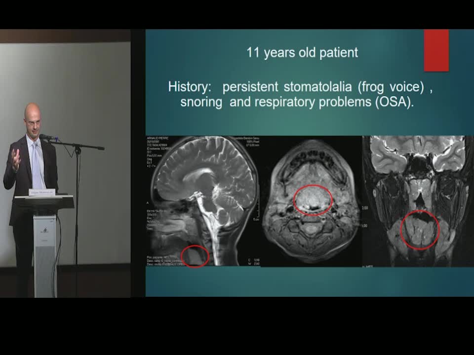 Robot: la Trans Oral Robotic Surgery | Diretteweb